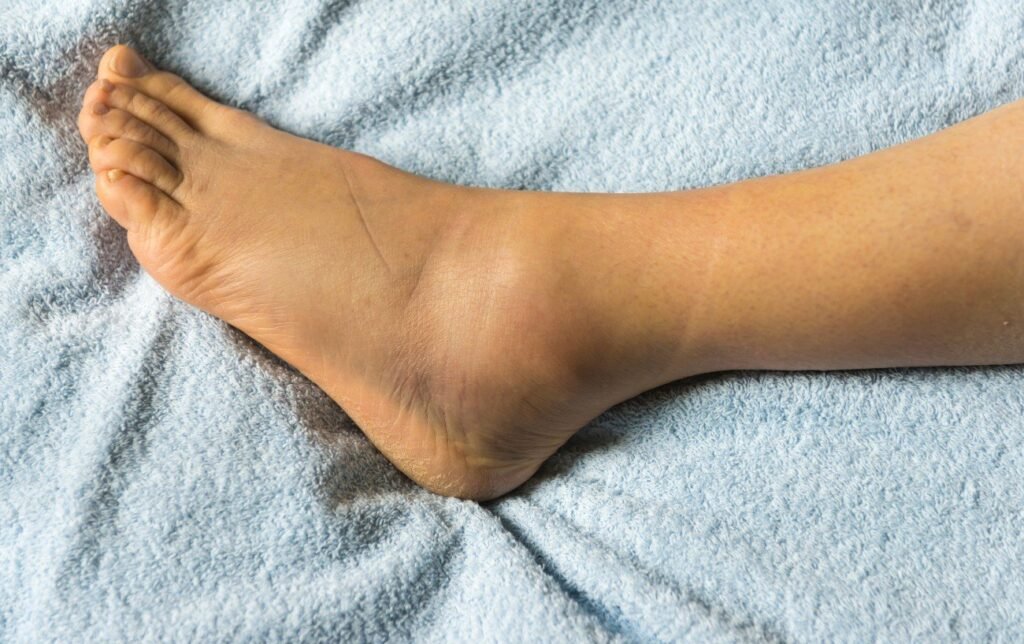 Pourquoi ai-je mal aux chevilles quand je cours ? 5 causes possibles ...